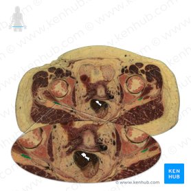 Piriformis muscle: Origin, insertion and action | Kenhub