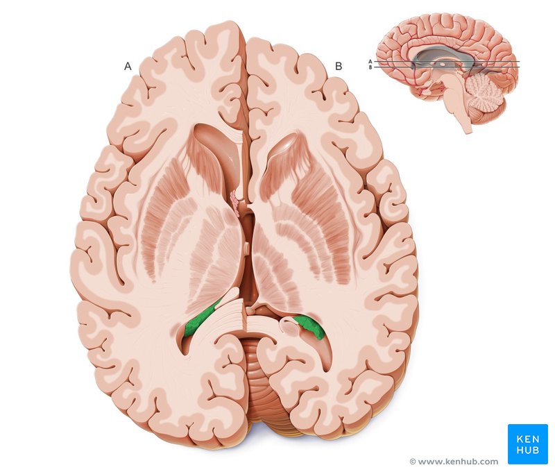 Choroid plexus: Anatomy, histology and clinical aspects | Kenhub