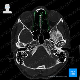 Ethmoid bone: Anatomy, borders and development | Kenhub