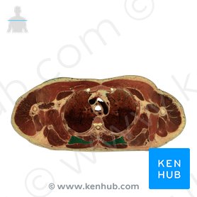 Rhomboids: Origin, insertion, innervation and function | Kenhub