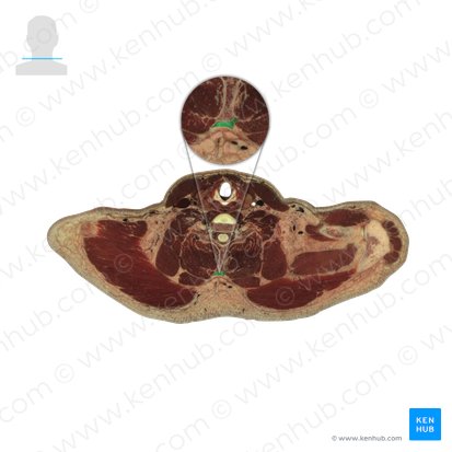 Nuchal ligament: Anatomy, attachments and function | Kenhub