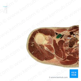 Músculo Subclávio - Origem, inserção, inervação e ação | Kenhub