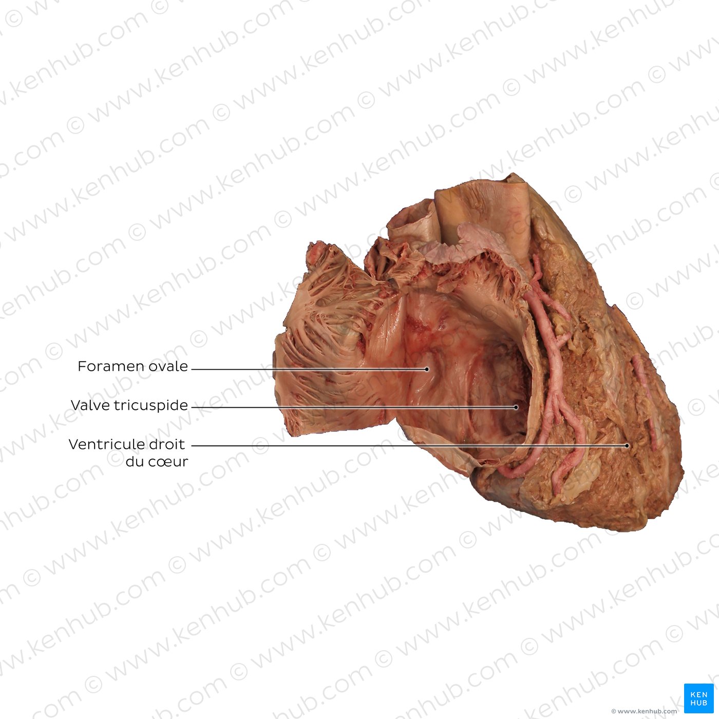 Valves cardiaques : anatomie, structure et fonctions | Kenhub