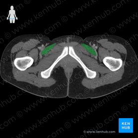 Pectineus: Origin, insertion, innervation, action | Kenhub