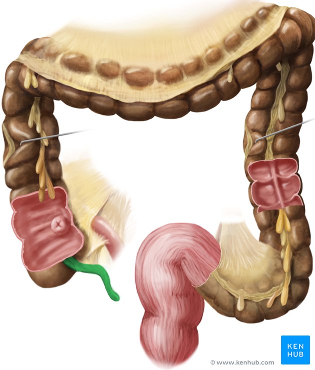 Appendix Vermiformis Anatomie Histologie Und Funktion Kenhub