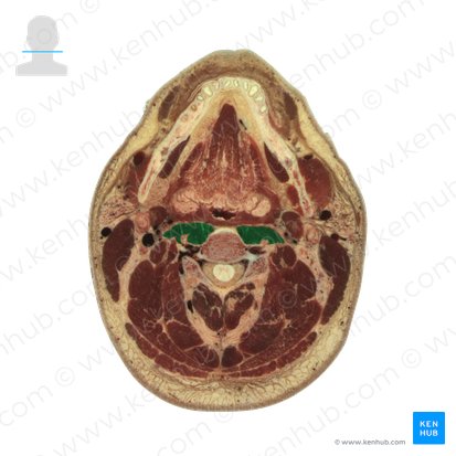 Prevertebral muscles, longus capitis muscle, anatomy | Kenhub
