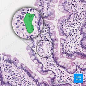 Lymphsystem - Aufbau, Organisation, Elephantiasis | Kenhub