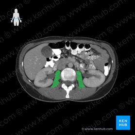 Psoas major: Origins, insertions, actions, innervation | Kenhub