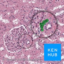 Juxtaglomerular apparatus: Structure and function | Kenhub