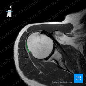 Teres minor: Origin, insertion, action and innervation | Kenhub