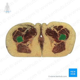 Femur (Oberschenkelknochen) - Anatomie, Aufbau und Bänder | Kenhub