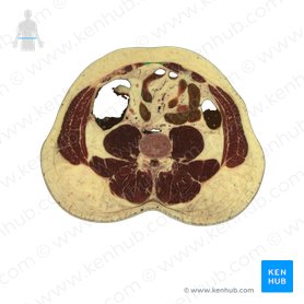 Musculus pyramidalis - Anatomie & Funktion | Kenhub