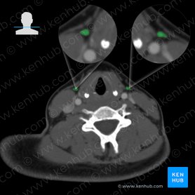 Anterior jugular vein: Anatomy, tributaries, drainage | Kenhub