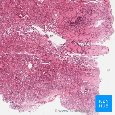 Endocrine system: Microscopic anatomy and functions | Kenhub