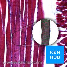 I band: Anatomy and function | Kenhub