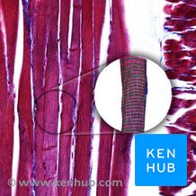 A band: Anatomy and function | Kenhub