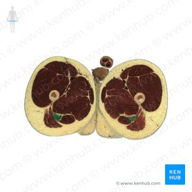 Ischiocrurale Muskulatur: Muskeln, Funktion & Verkürzung | Kenhub