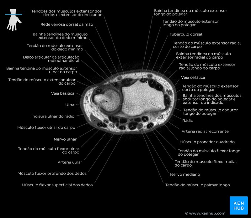 Ressonância Magnética (RM) - Tipos, indicações | Kenhub
