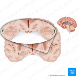 Lateral ventricles: Anatomy and function | Kenhub