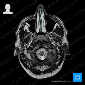 Nasal conchae: Anatomy, structure and function | Kenhub