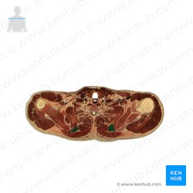 Rhomboids: Origin, insertion, innervation and function | Kenhub