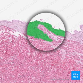 Herzwand: Endokard, Myokard und Perikard | Kenhub