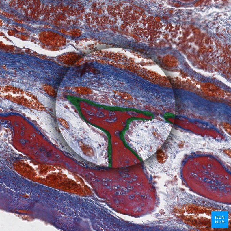 Osteoid: Anatomical structure and function | Kenhub