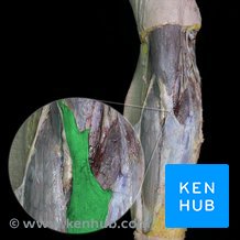 bicipital aponeurosis injury