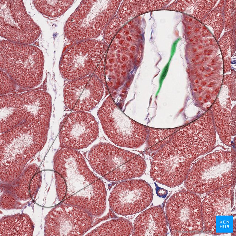 Fibroblast: Histological structure and function | Kenhub