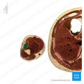 Extensor radial longo do carpo: anatomia e funções | Kenhub