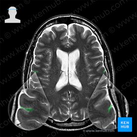 Central sulcus: Anatomy, location and contents | Kenhub