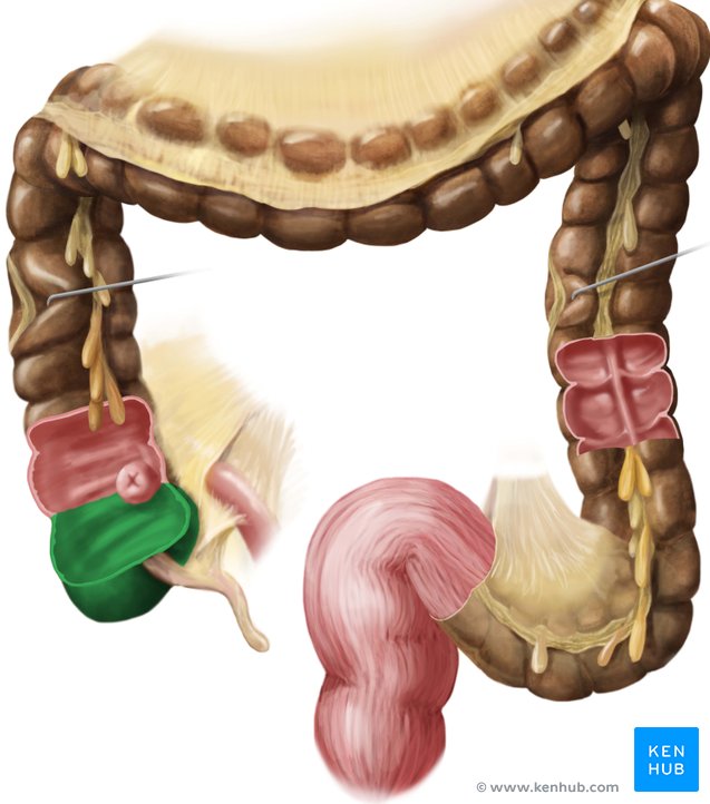 Caecum (Blinddarm): Anatomie, Lage, Versorgung, Funktion | Kenhub