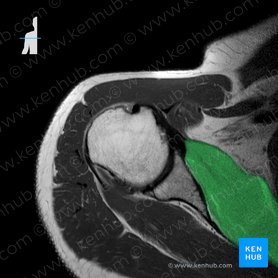 Scapulothoracic joint: Anatomy, function | Kenhub