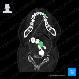 Canine tooth: anatomy, location and function | Kenhub