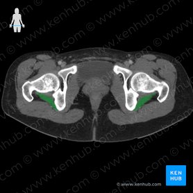 Inferior gemellus: Origin, insertion, innervation, action | Kenhub