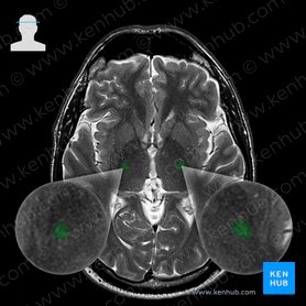 Pyramidenbahn - Anatomie, Verlauf, Kreuzung und Funktion | Kenhub