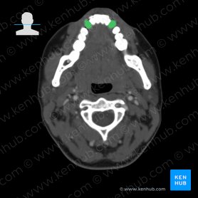 Canine tooth: anatomy, location and function | Kenhub