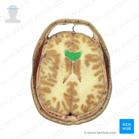 Corpus callosum: Anatomy, function and clinical aspects | Kenhub