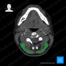 Splenius capitis: Origin, insertion, actions, innervation | Kenhub