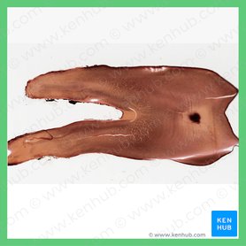 Zahn (Dens) - Anatomie, Aufbau, Plaque und Karies | Kenhub