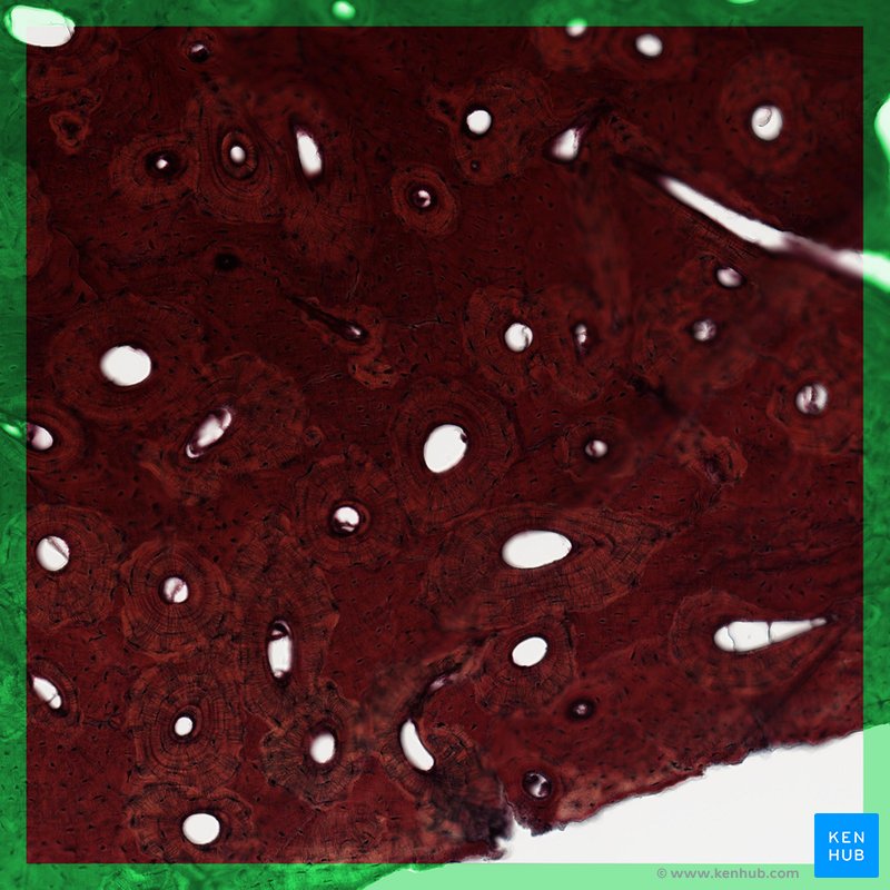 Bone: Histology, constituents and types | Kenhub