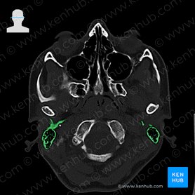 Innerer Gehörgang - Anatomie und Klinik | Kenhub