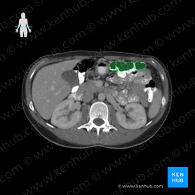 Large intestine: Anatomy, blood supply and innervation | Kenhub