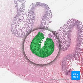 Colon (Grimmdarm) - Anatomie, Histologie und Innervation | Kenhub