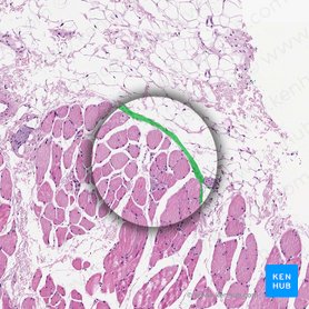 Skeletal muscle tissue: Histology | Kenhub