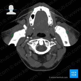 Cavidade oral - Anatomia, língua, músculos e inervação | Kenhub