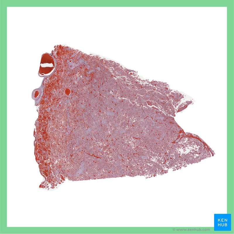 Plazenta: Anatomie, Entwicklung und Funktion | Kenhub