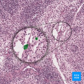 Macrophages: anatomy, structure and function | Kenhub
