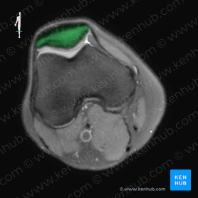 Patella: Anatomy, function and clinical aspects | Kenhub