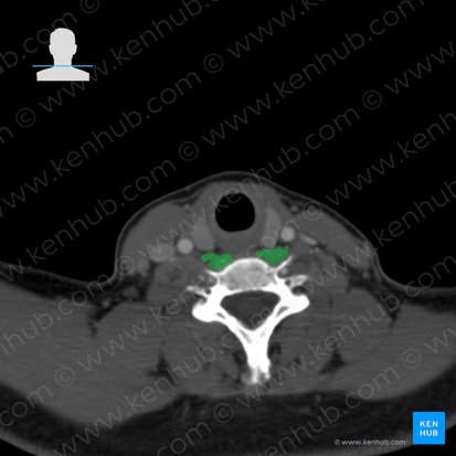 Prevertebral muscles, longus capitis muscle, anatomy | Kenhub
